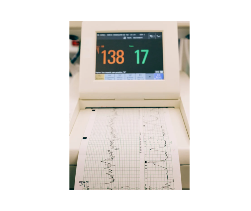 ¿Que es un monitor fetal? - ISHTAR